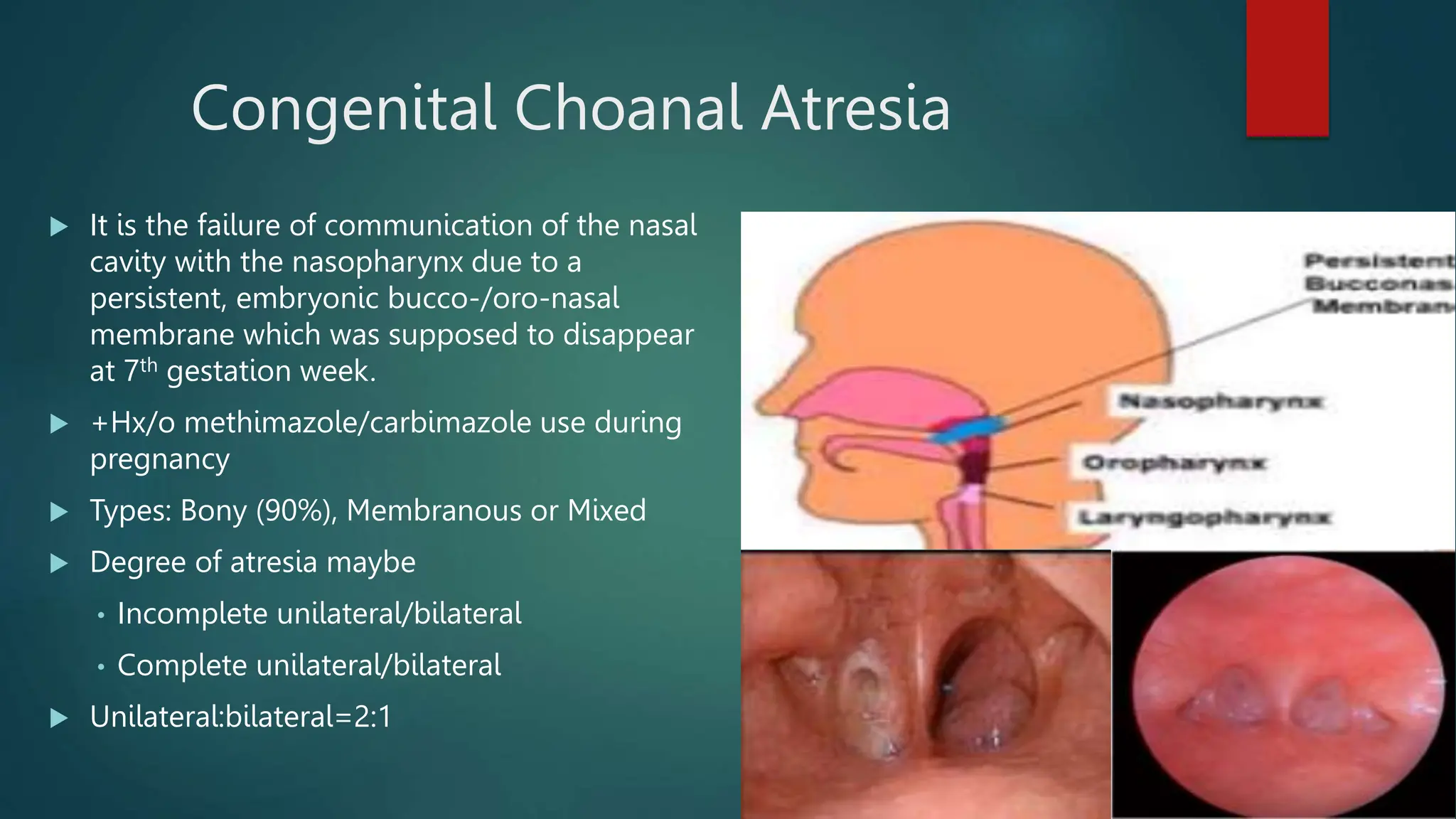 assignx_cong diseaseses_nose&pns_mashrab.pptxassignx_cong diseaseses ...