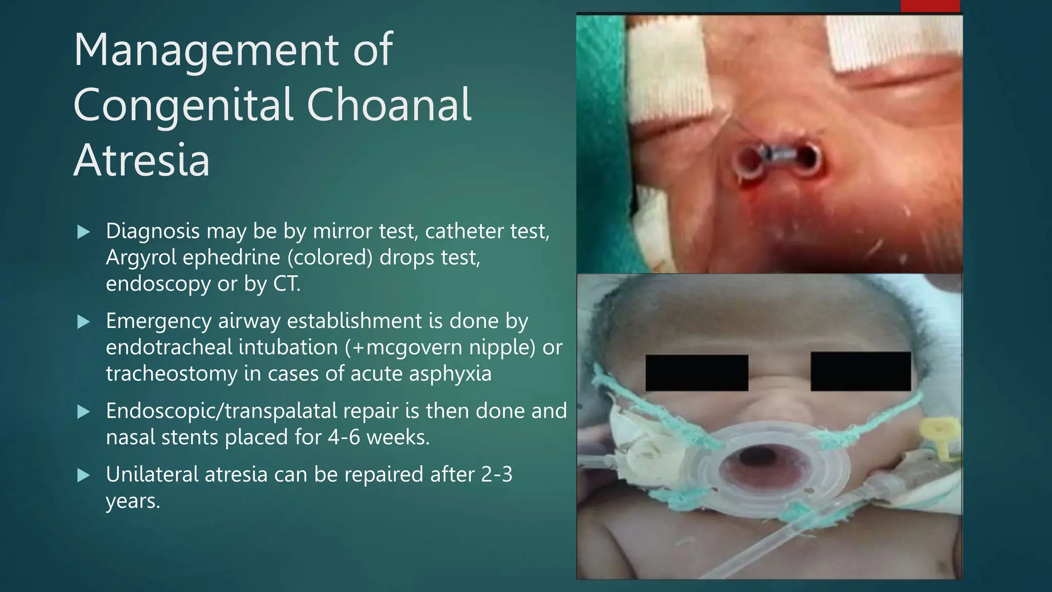 assignx_cong diseaseses_nose&pns_mashrab.pptxassignx_cong diseaseses ...
