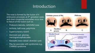 assignx_cong diseaseses_nose&pns_mashrab.pptxassignx_cong diseaseses ...