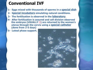 Assisted Reproductive Technology | PPT