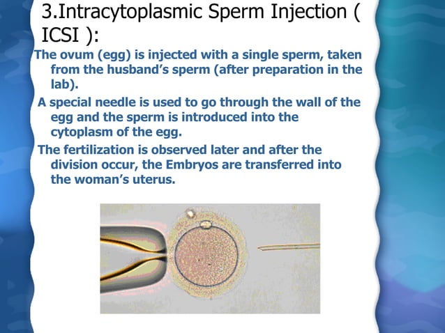 Assisted Reproductive Technology | PPT | Pregnancy | Reproductive Health