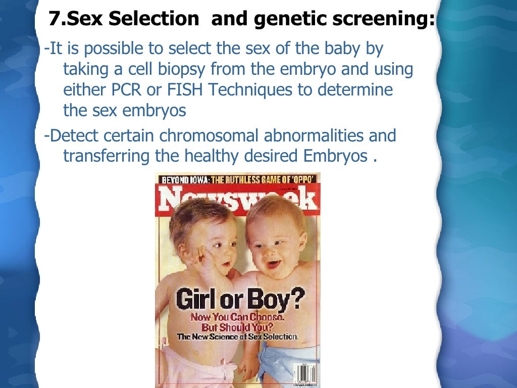Assisted Reproductive Technology