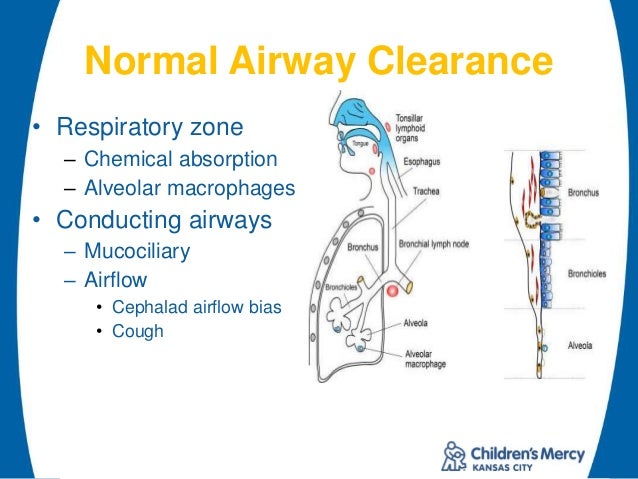 Assisted Airway Clearance in Pediatric Respiratory Disease