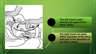 ASSISTED BREECH DELIVERY Dr. Kavitha.pptx