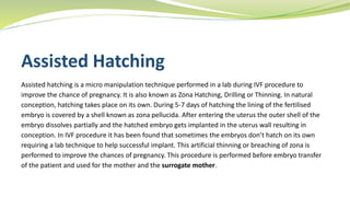Assisted hatching | PPTX