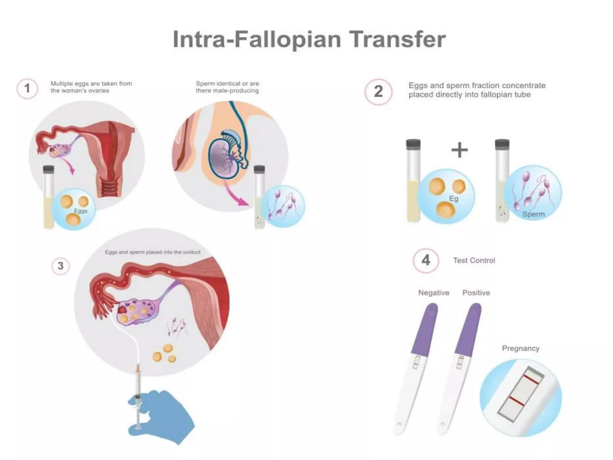 Assisted Reproductive Technique | PDF