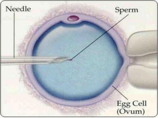 Assisted Reproductive Technique | PDF