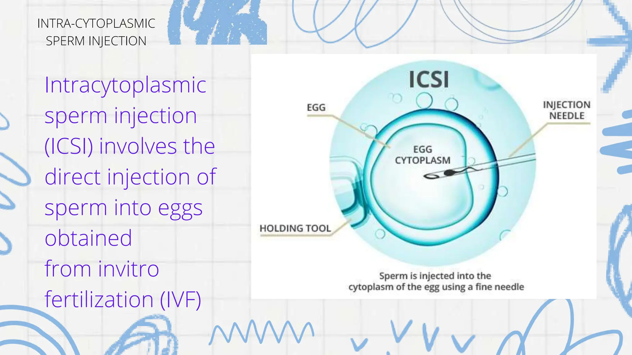 ASSISTED REPRODUCTIVE TECHNIQUES.powerpoint | PPTX