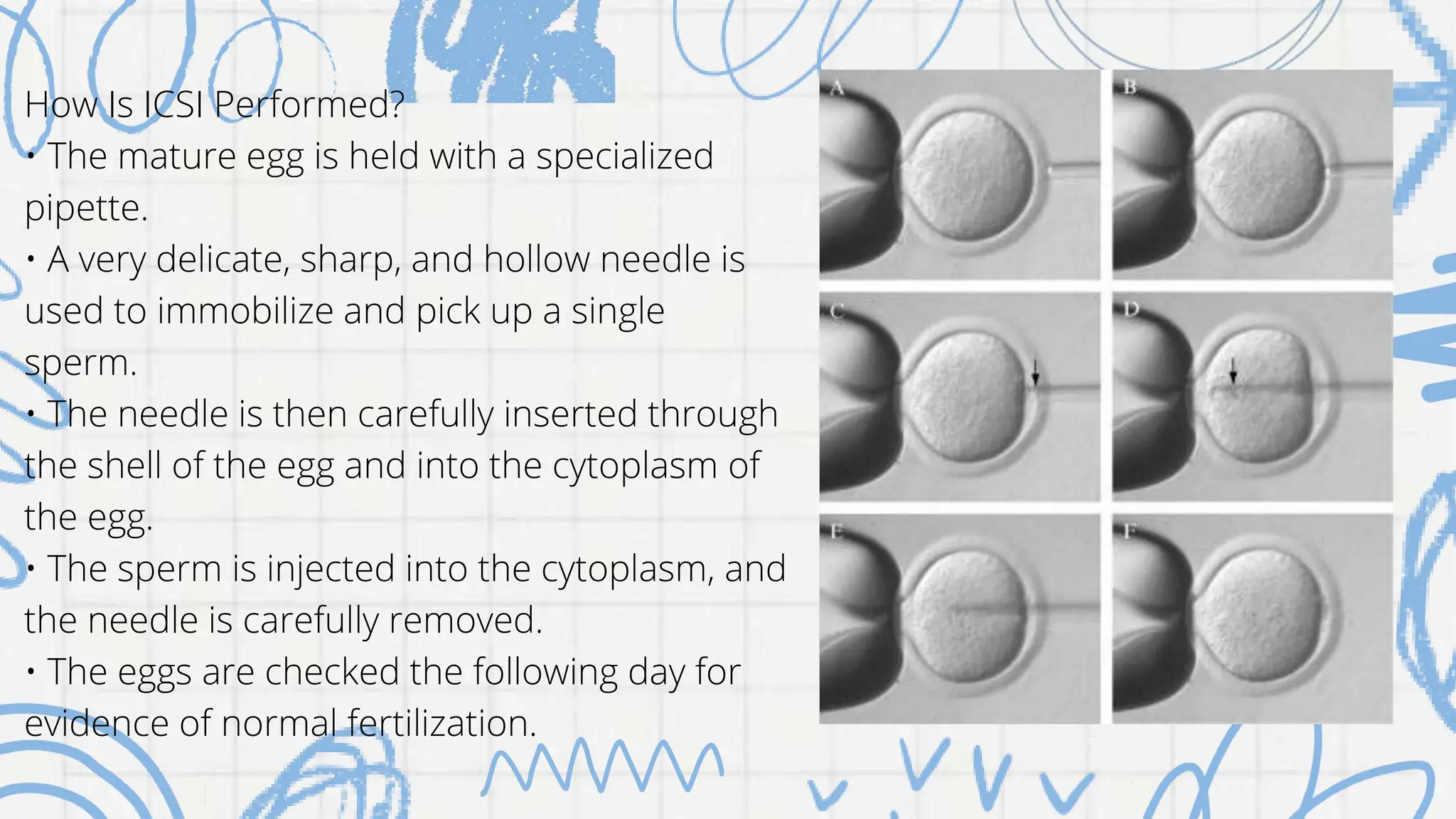 Assisted Reproductive Techniquespowerpoint Ppt