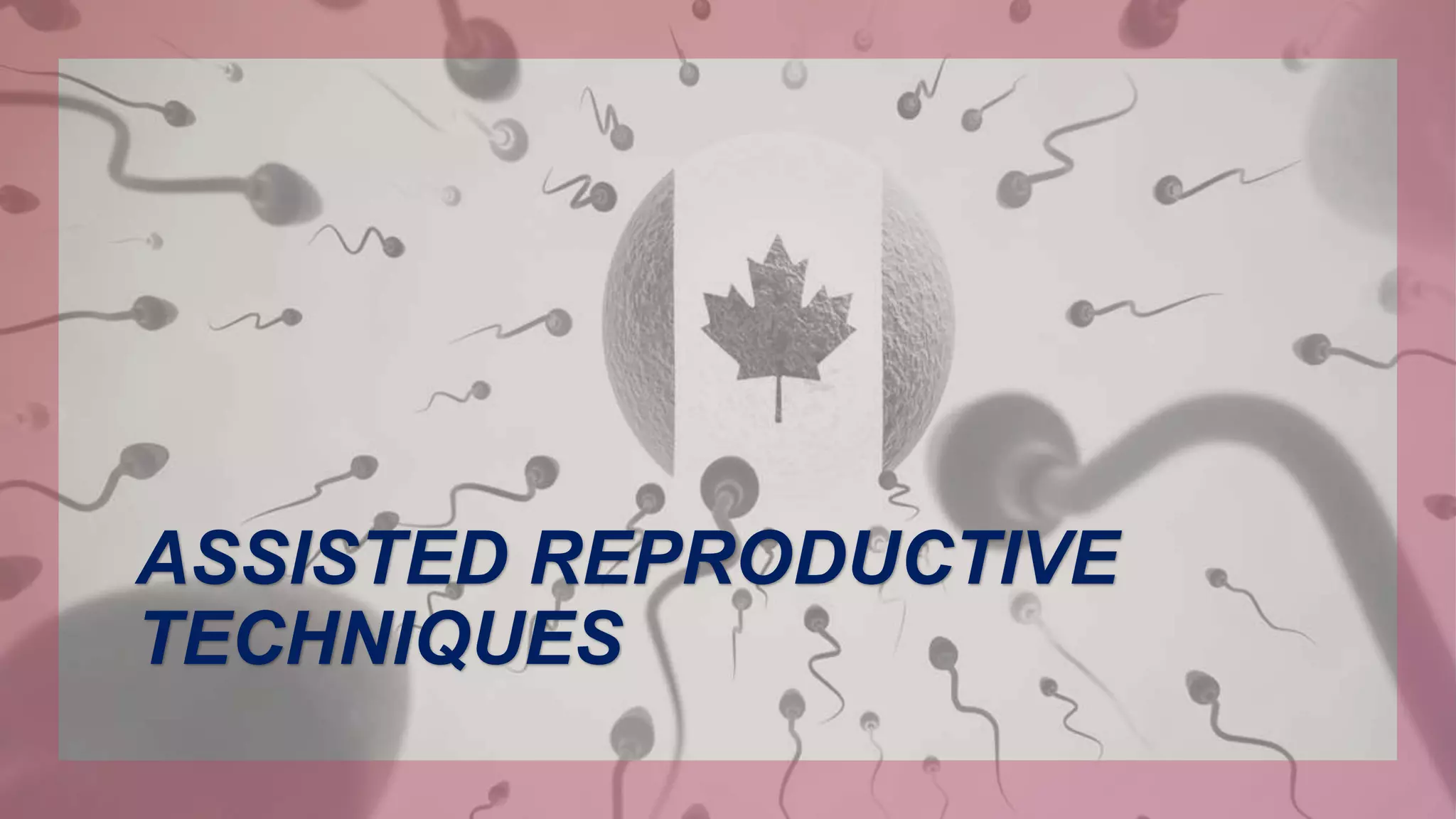 Assisted reproductive techniques | PPT