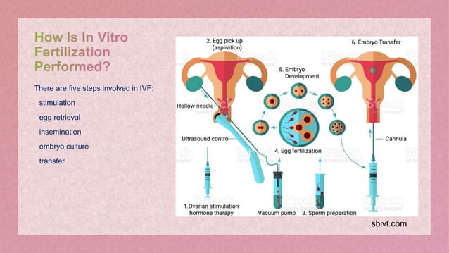 Assisted reproductive techniques | PPT