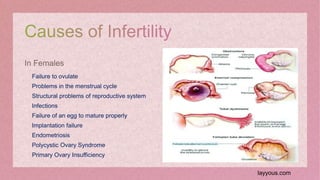 Assisted reproductive techniques | PPT