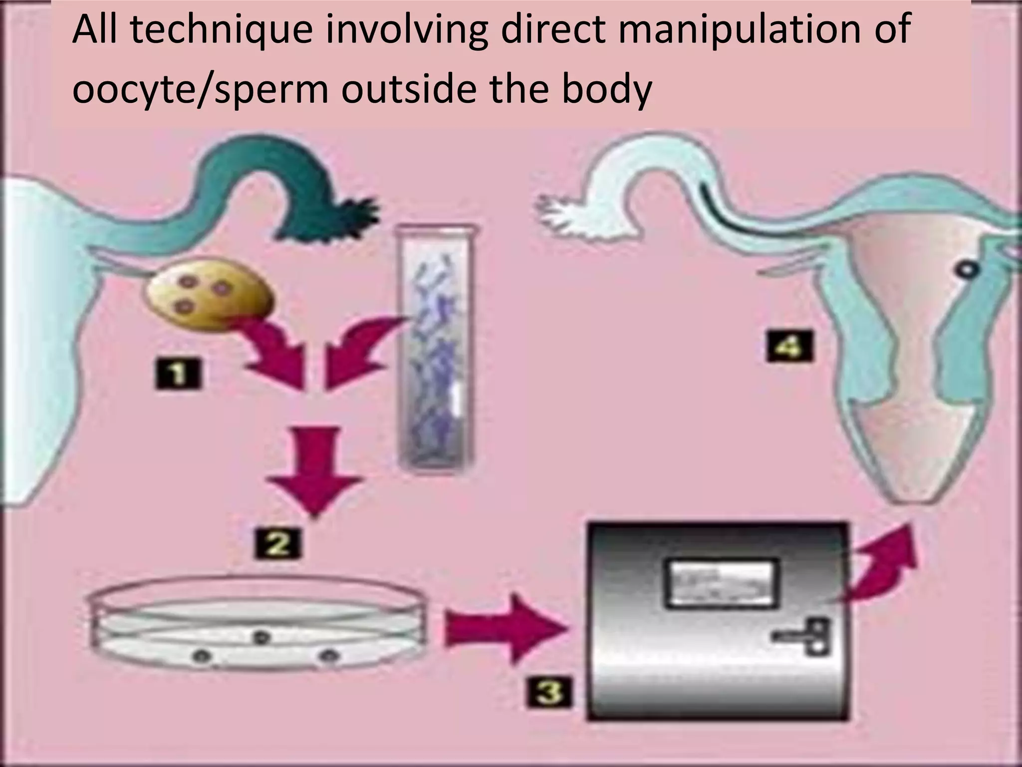 Assisted reproductive techniques | PPTX