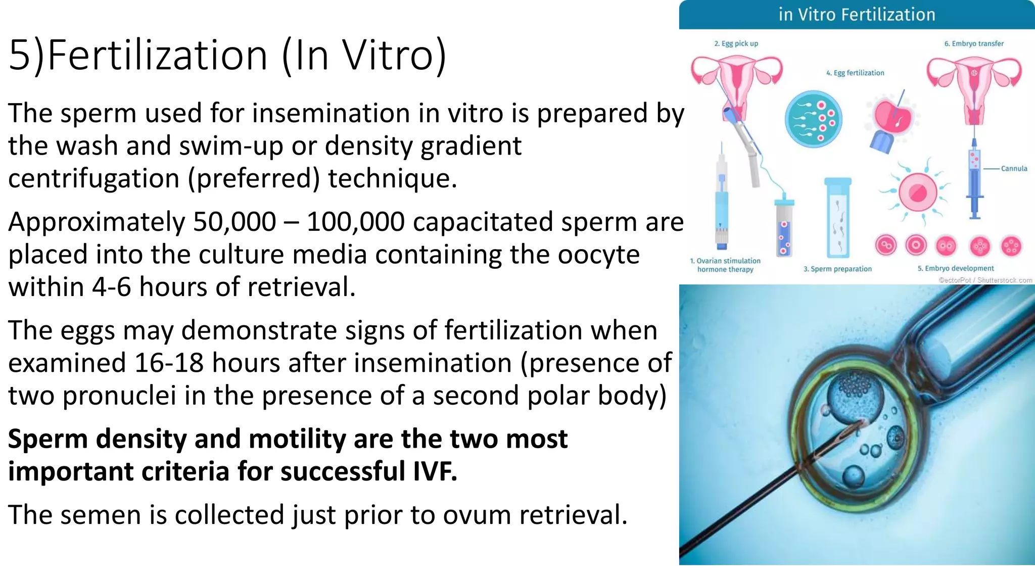 Assisted reproductive technologies (art) | PPTX
