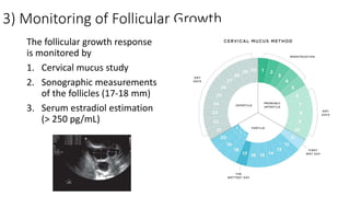 Assisted reproductive technologies (art) | PPTX