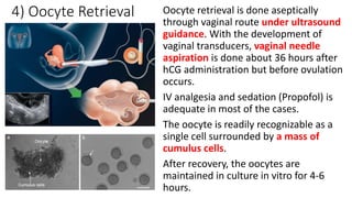 Assisted reproductive technologies (art) | PPTX