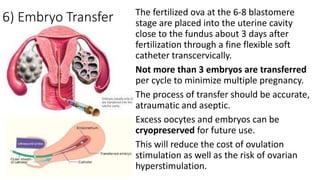 Assisted reproductive technologies (art) | PPTX
