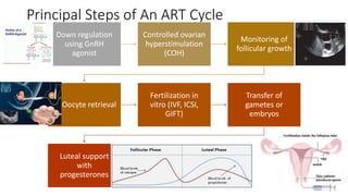 Assisted reproductive technologies (art) | PPTX