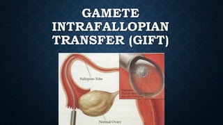 Assisted reproductive technology | PPTX | Infertility | Reproductive Health