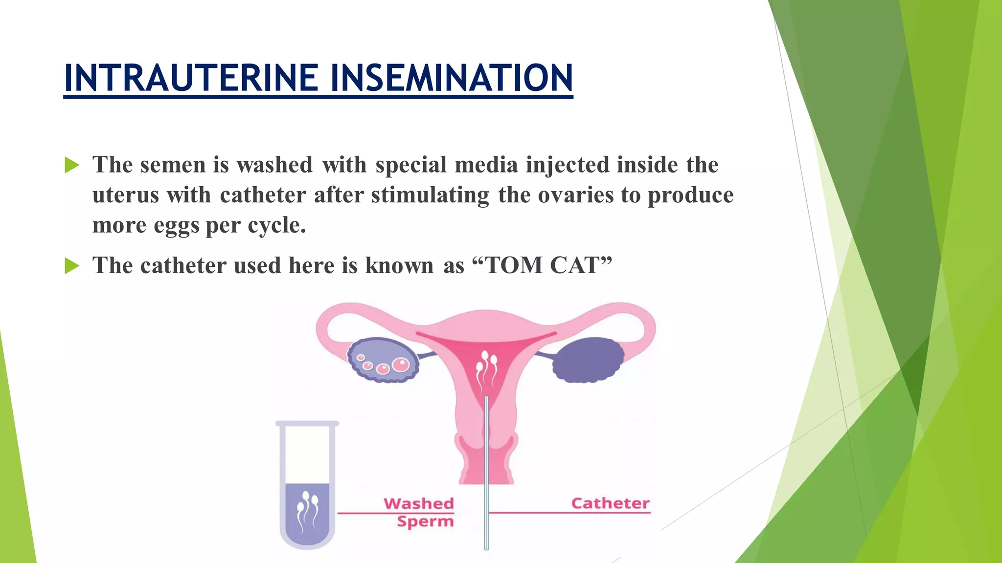 Assisted reproductive technology | PDF