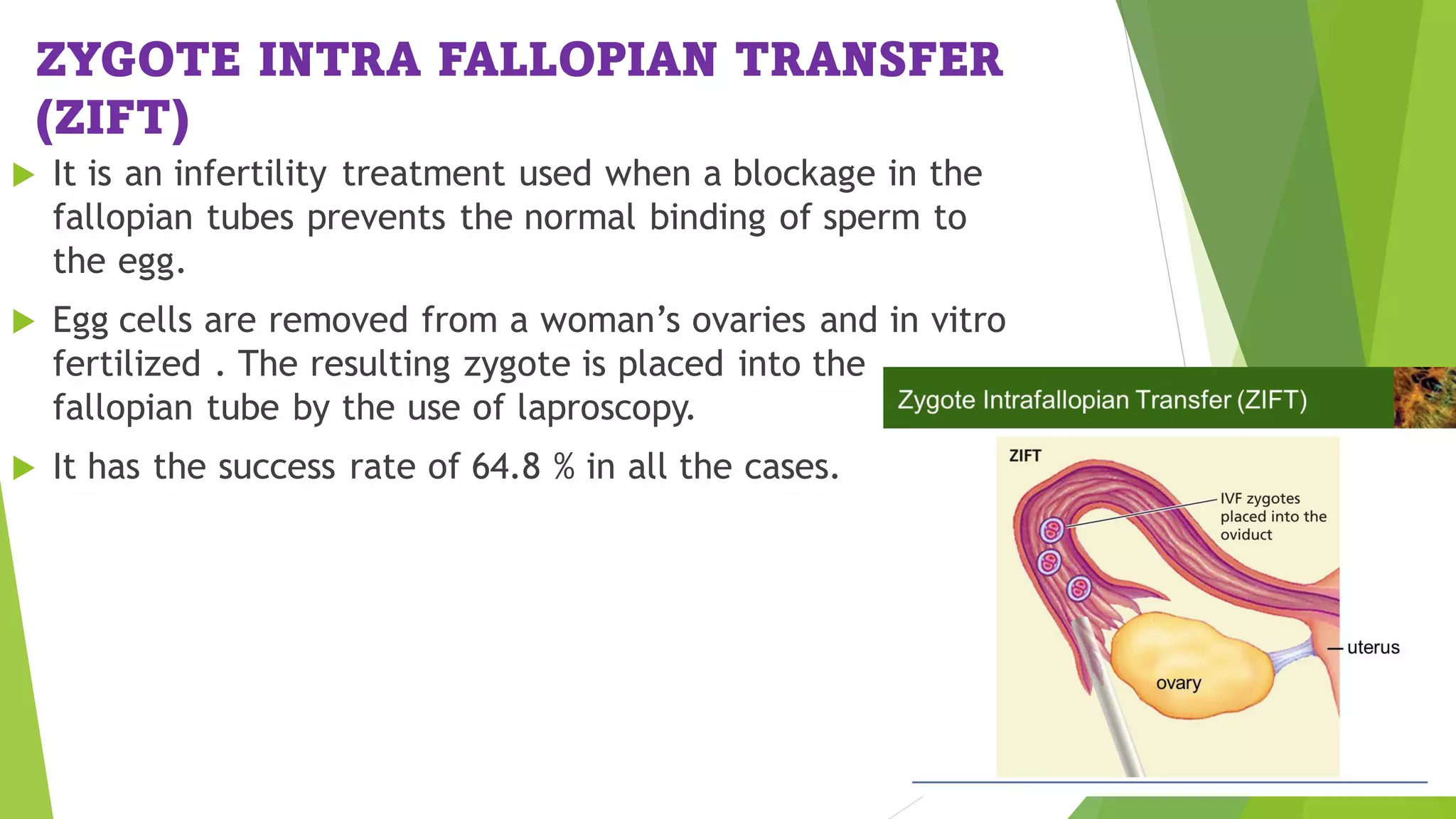 Assisted reproductive technology | PDF