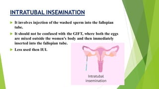 Assisted reproductive technology | PDF