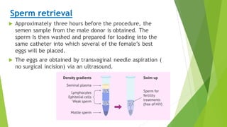 Assisted reproductive technology | PDF