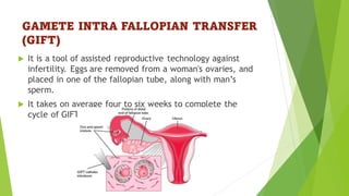 Assisted reproductive technology | PDF