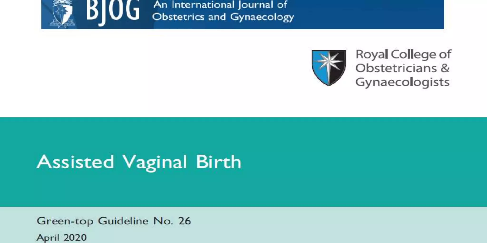Assisted vaginal births, RCOG | PPTX