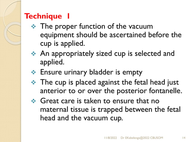 ASSISTED VAGINAL DELIVERY 2022-1 - Copy.pdf