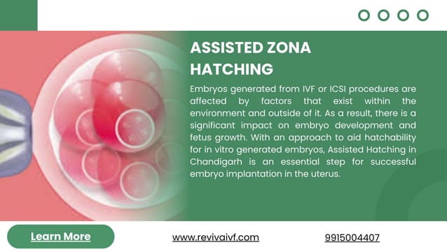 Assisted Zona Hatching Chandigarh - Reviva IVF | PPTX