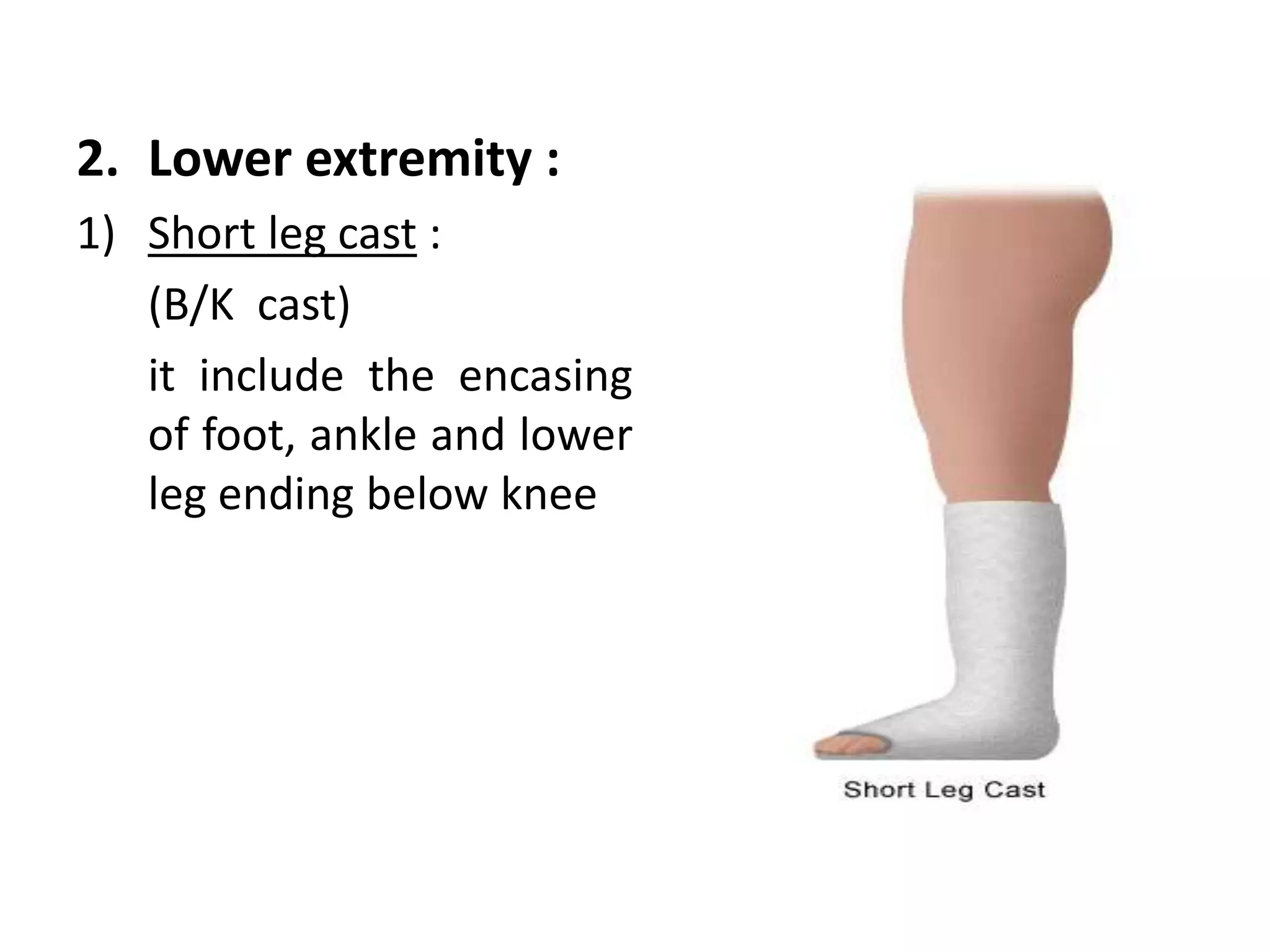 Assist in application & Removal of plaster cast. | PPTX