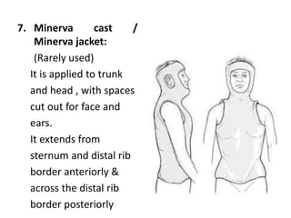 Minerva Cast