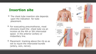 Assisting in Intercostal Chest Drain (ICD) Insertion (2).pptx