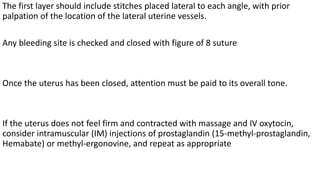 Assisting in lower segment cesarean section | PPTX