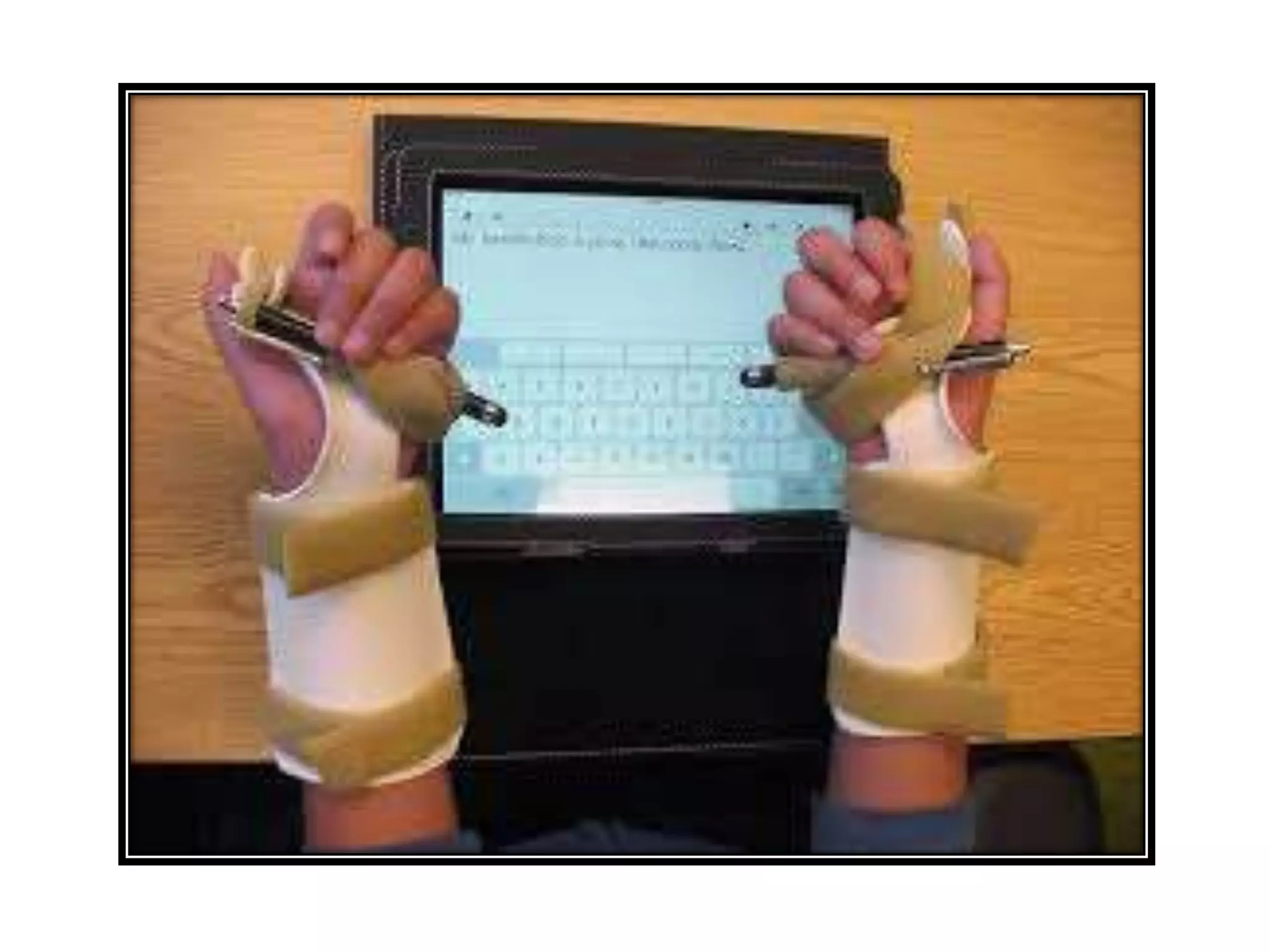 Assistive & Adaptive technology | PPTX