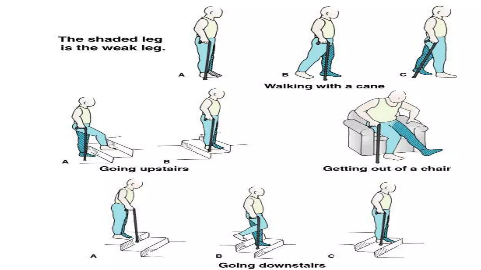 Use of assistive devices | PPTX