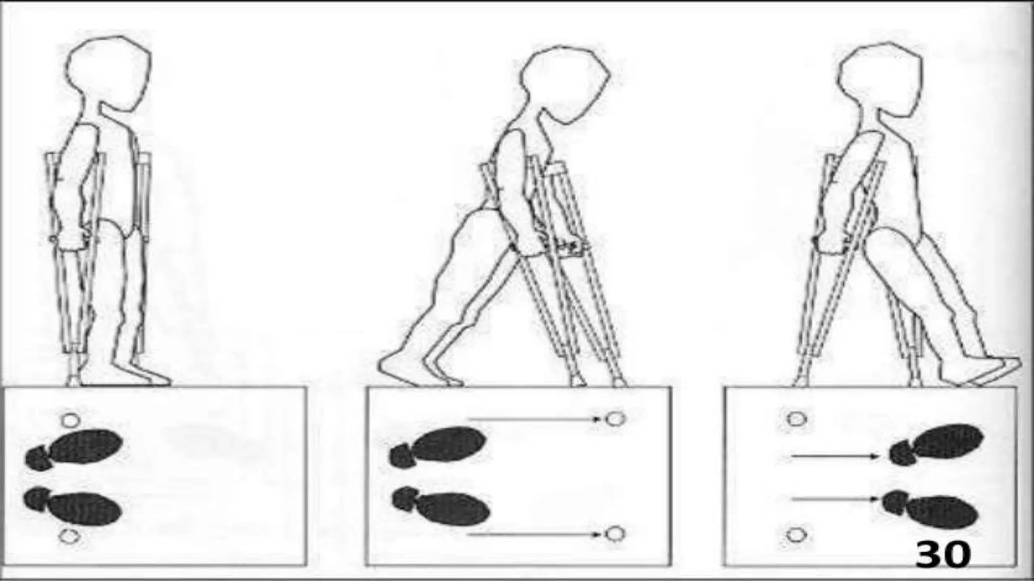 Use of assistive devices | PPTX