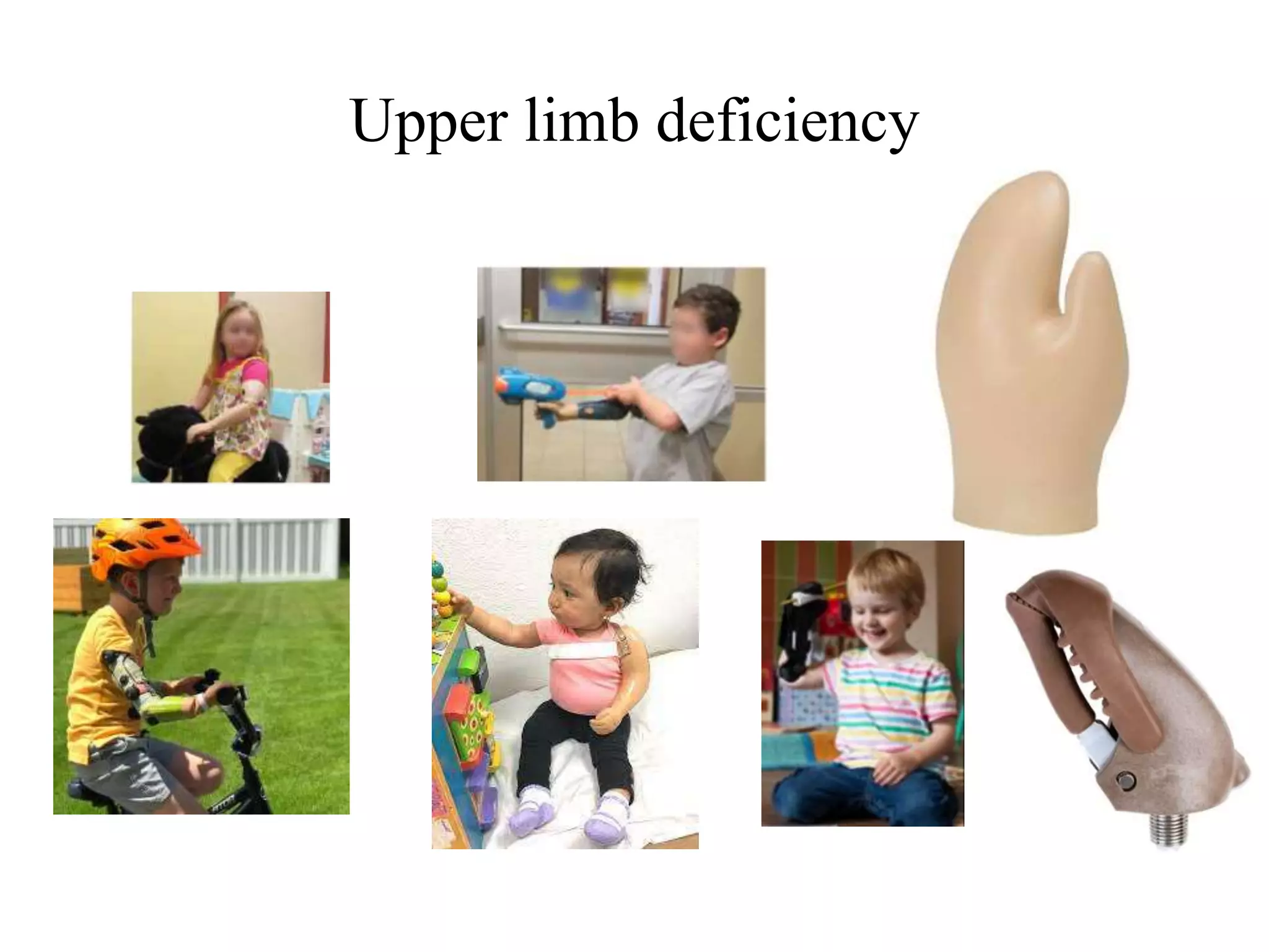 Assistive devices &technology for peadiatric rehabilitation | PPTX