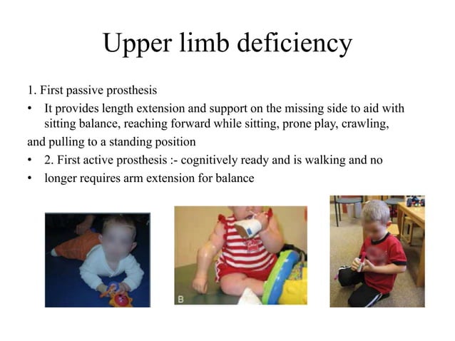 Assistive devices &technology for peadiatric rehabilitation | PPTX