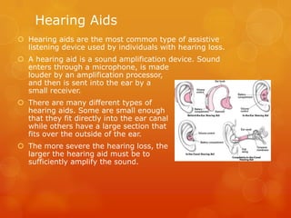 Assistive Listening Devices | PPTX