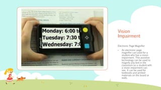 Assistive technology kelly woodson | PPTX