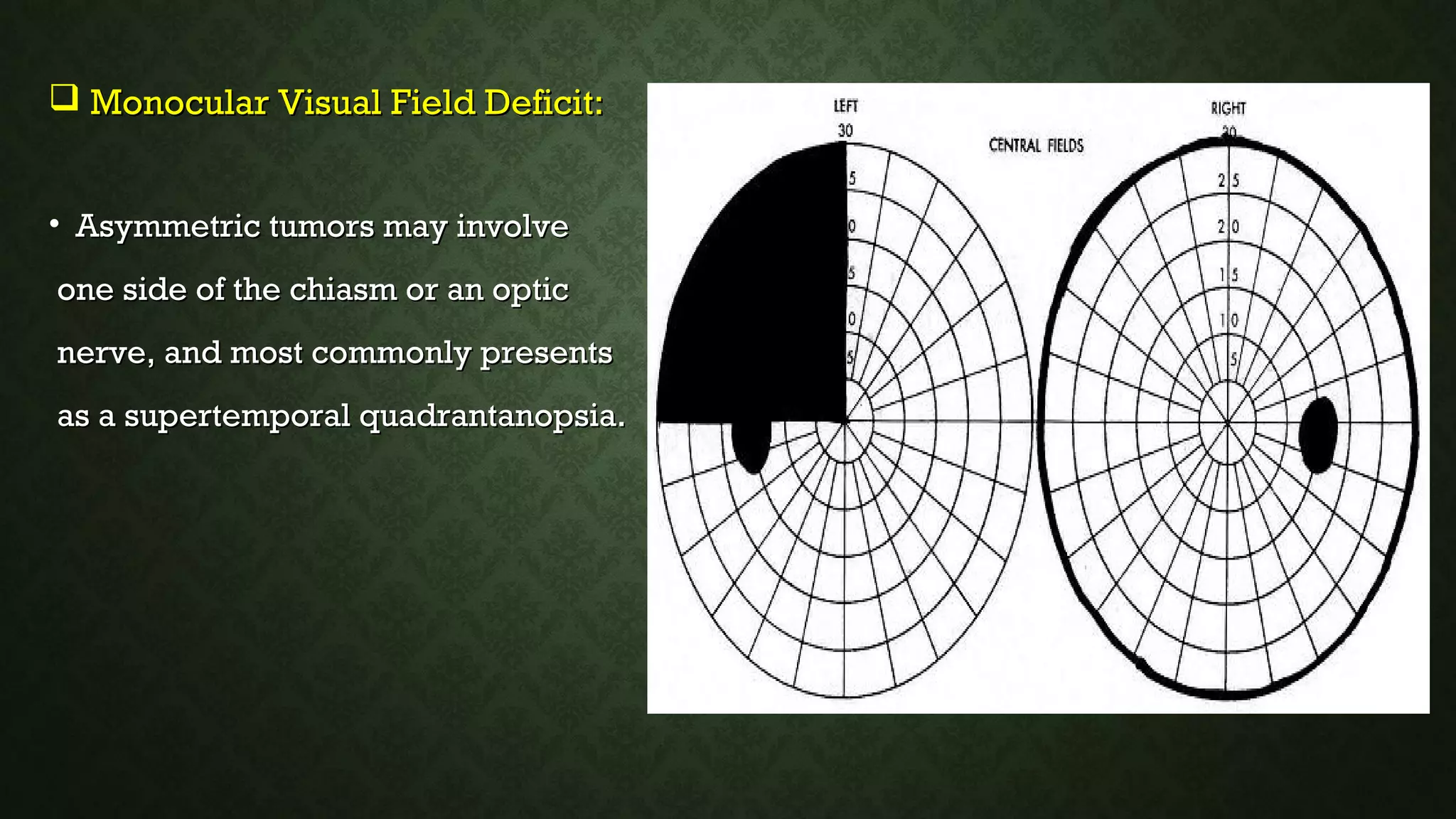 Associated eyes diseases | PPT