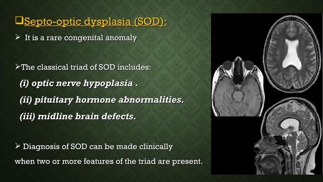 Associated eyes diseases | PPT