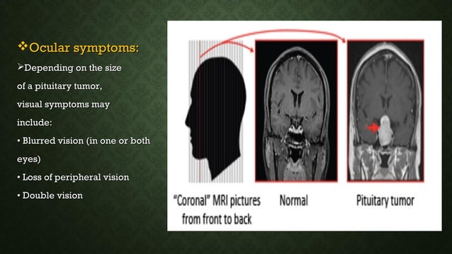 Associated eyes diseases | PPT