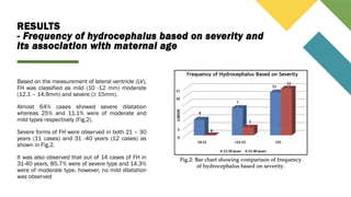 Association of fetal hydrocephalus with other embryological anomalies.pptx