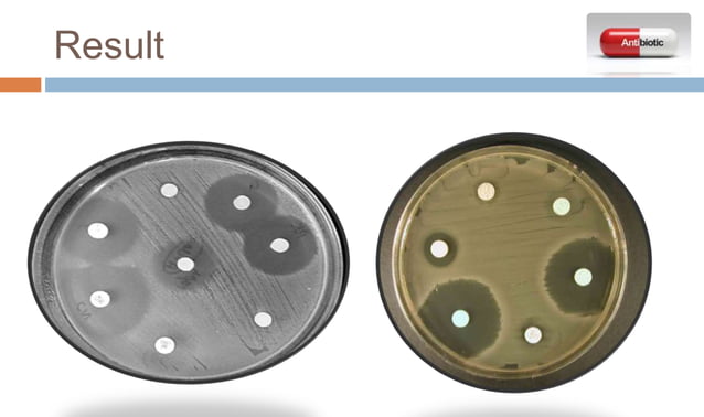 Antibiotic sensitivity testing (AST) | PPTX