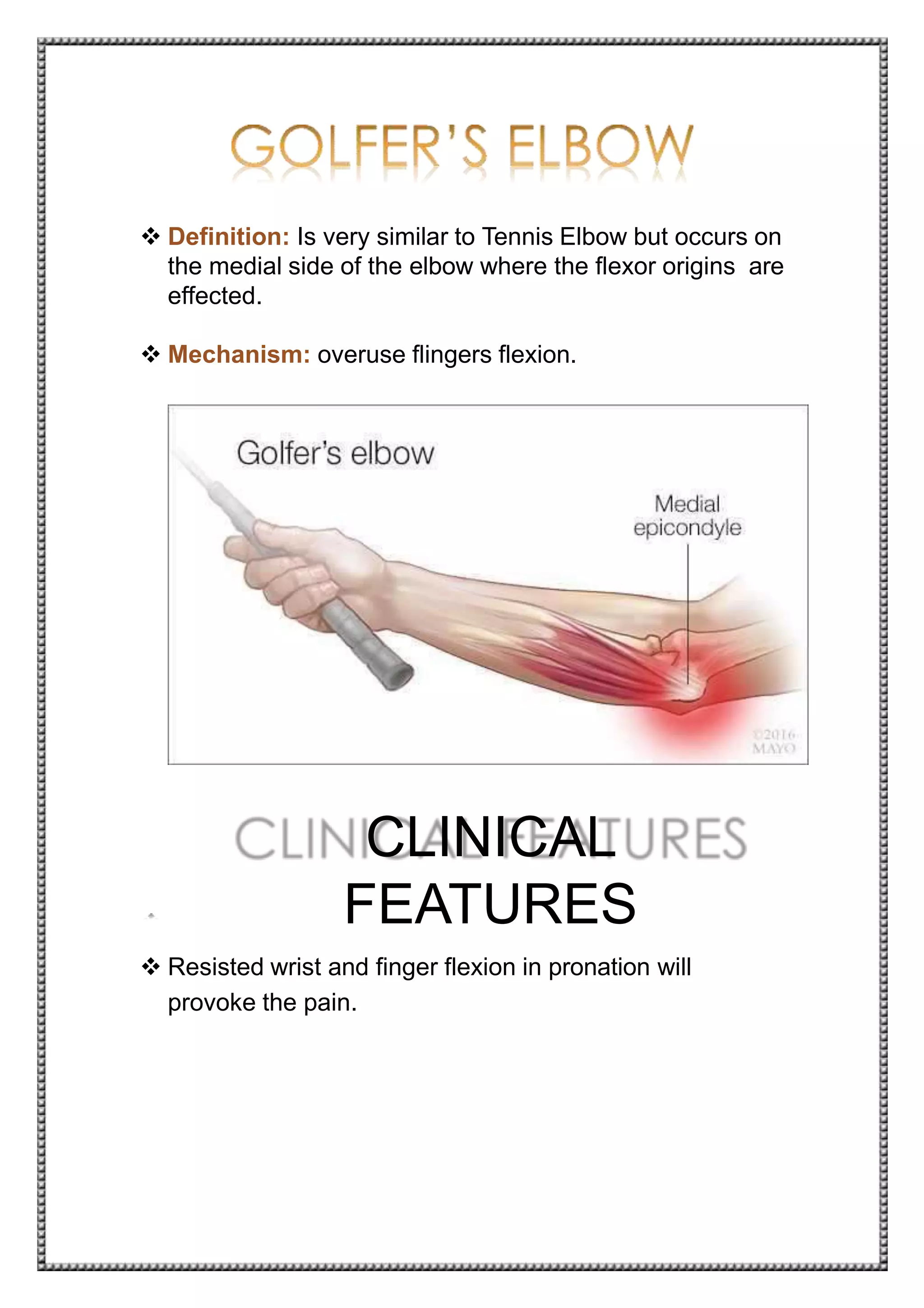 SPORTS INJURIES OF UPPER EXTREMITIES | PPTX
