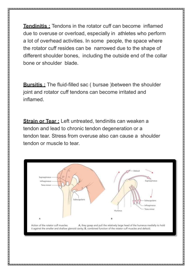 SPORTS INJURIES OF UPPER EXTREMITIES | PPTX | Death, Injury, or ...