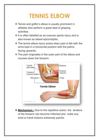 SPORTS INJURIES OF UPPER EXTREMITIES | PPTX